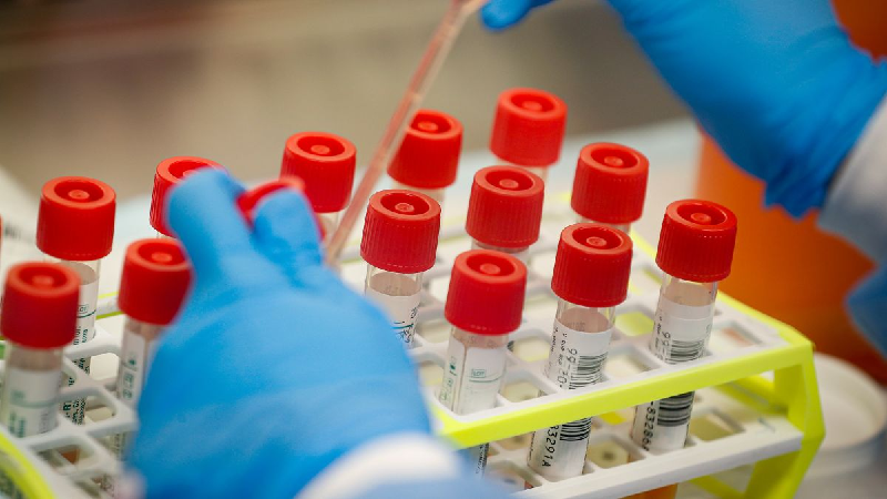 ions And Answers To Common ions About Third Party Lab Testing 